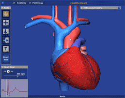 www.cardioanatomy.com - 3D Interactive Heart Viewer